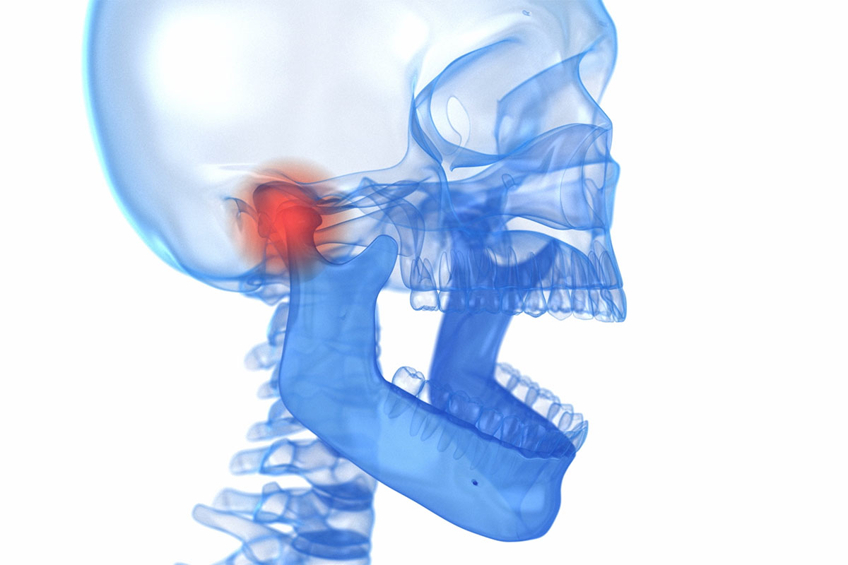 Jaw Pain Relief in Calgary | Expert TMJ Treatment at Marda Loop Braces