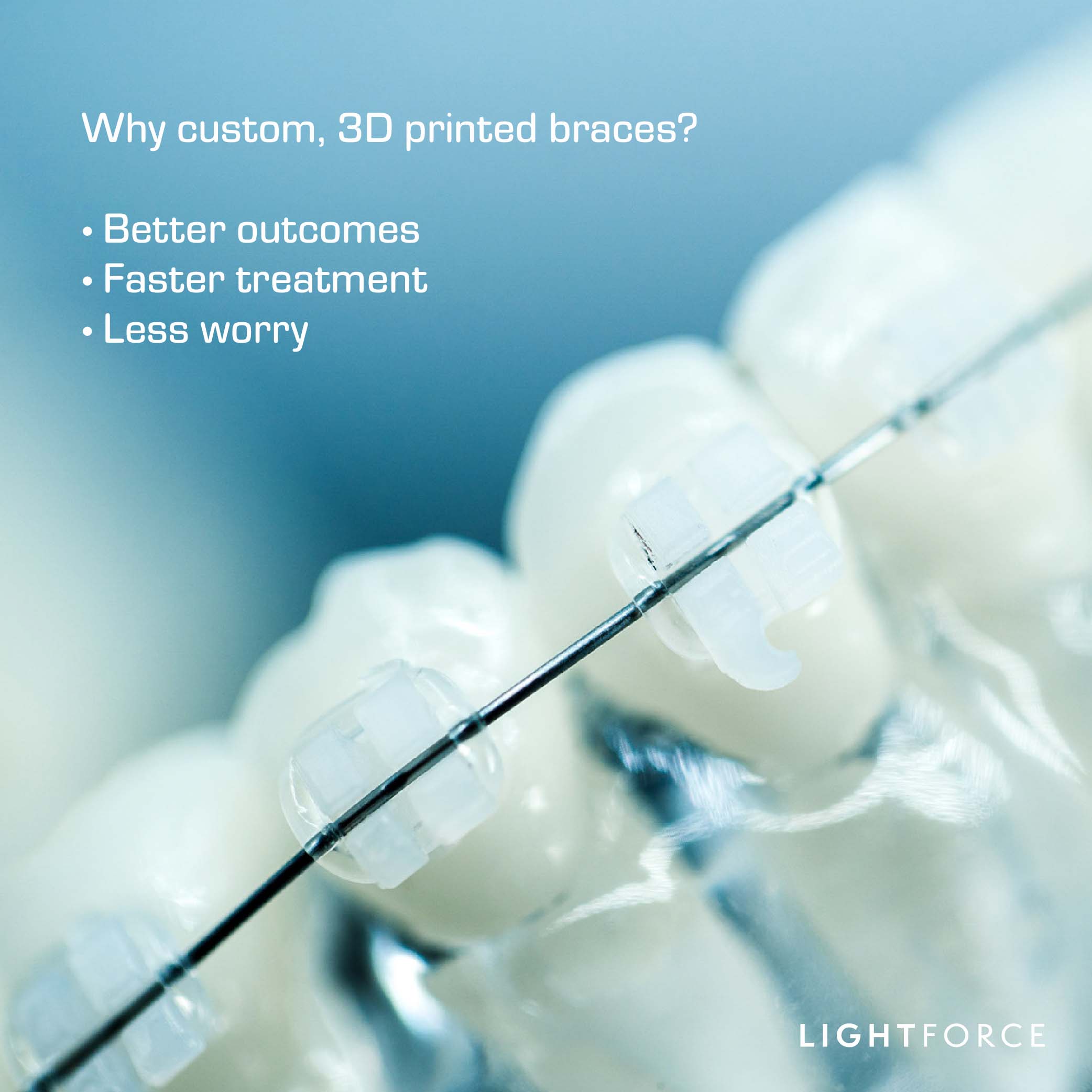 Calgary's Brightest Smiles: LightForce Clear Braces at Marda Loop Braces
