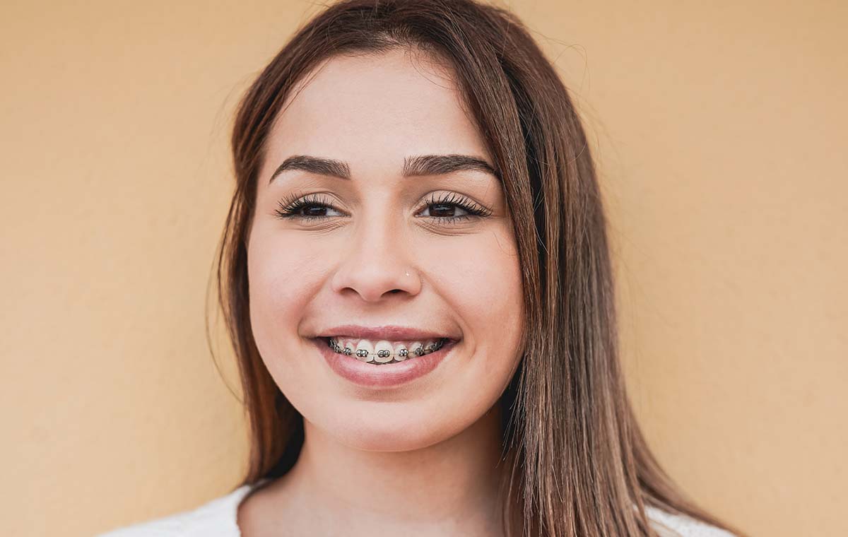 Get a Head Start on Smile Progress: Aevo at Marda Loop Braces